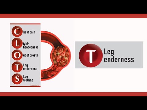 Leg Tenderness - another important sign