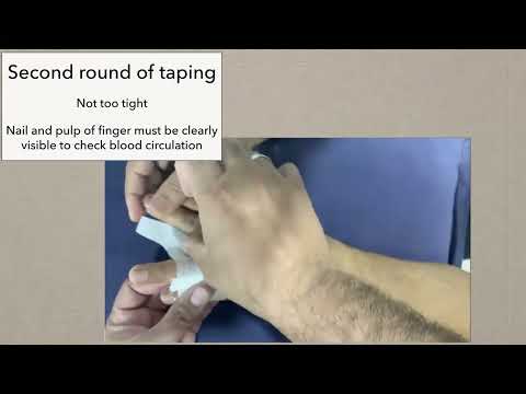 Buddy taping#buddy strapping technique