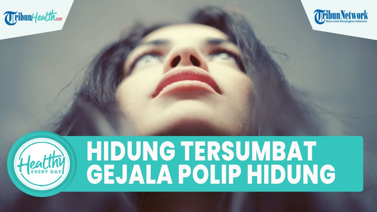 Waspadai Hidung Tersumbat hingga Sakit Kepala Bisa Jadi Gejala Polip Hidung, Ini Cara ...