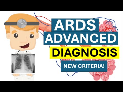 Acute Respiratory Distress Syndrome (ARDS) Advanced - Diagnosis | Clinical Medicine