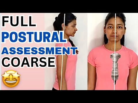 Postural Assessment | Posture Analysis | Standing Posture Analysis