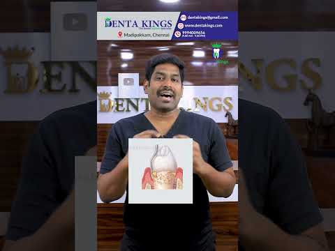 Dental Scaling செய்தும் வாயில் துர்நாற்றம், ஈறுகளில் ரத்தக் கசிவு ஏன் குறையவில்லை? Deep Scaling