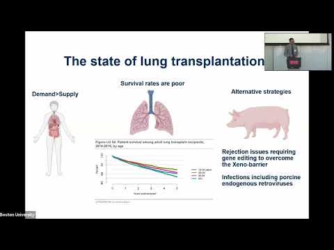 CTSI Translational Science Symposium 2025 - Dr. Finn Hawkins, MBBCh Presentation