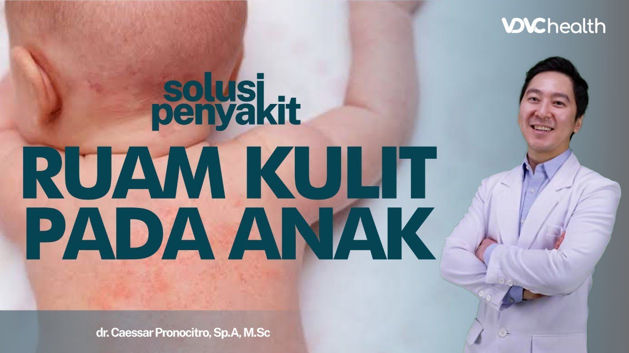 Waspada! Kenali Gejala Ruam Kulit Pada Anak yang Berbahaya | Kata Dokter