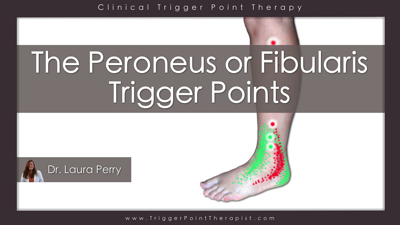 The Peroneus or Fibularis Trigger Points