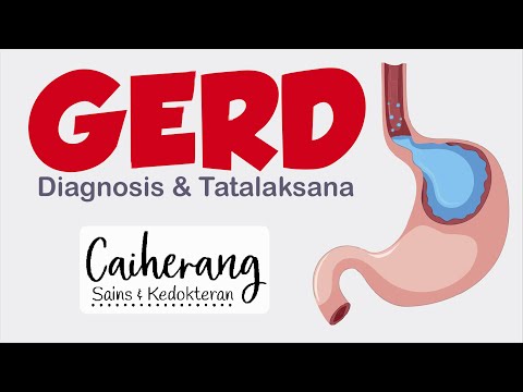 Mengenal Penyakit GERD | Diagnosis dan Tatalaksana GERD ...