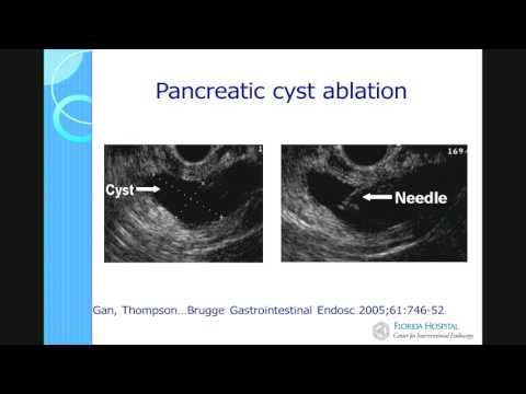 The Present and Future of Endoscopic Ultrasound