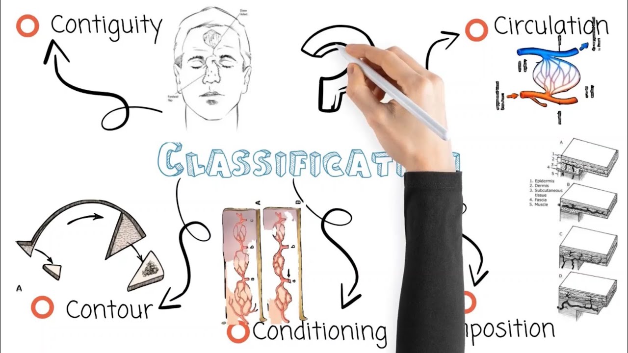 Plastic Surgery Flap Classifications — Made Simple