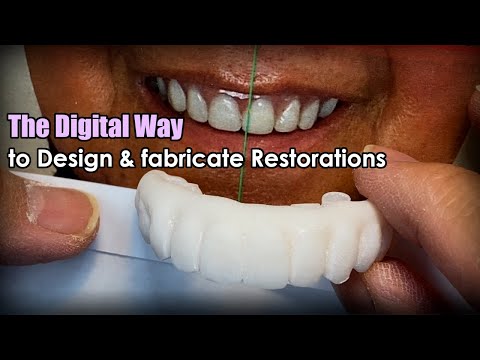 The Digital Way to Design & Fabricate Full-Mouth Restorations