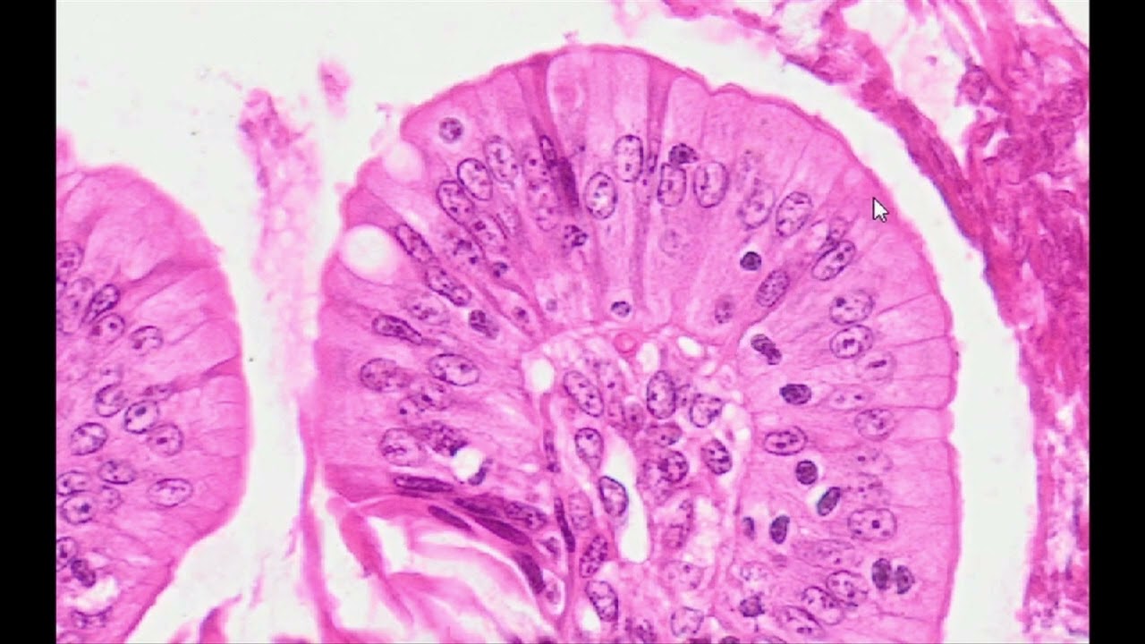 Simple Columnar Epithelium (H&E Staining) - PUMS Histology Slides Review Series