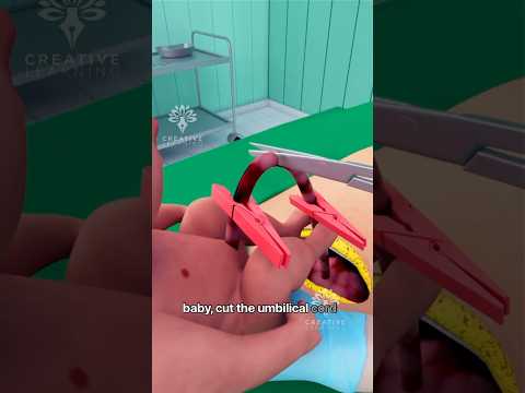 What Really Happens During a C-Section #short #viralvideo - Creativelearning3d