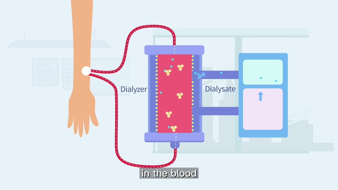 1. hemodialysis and hemoperfusion