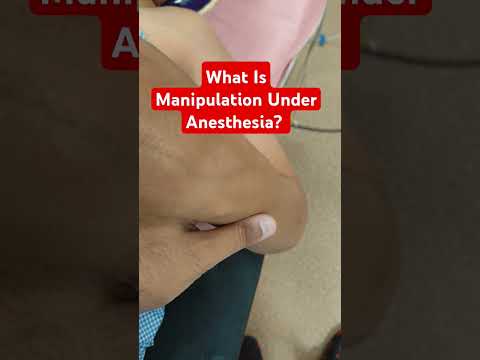 What Is Manipulation Under Anesthesia? Dr Sai Chandra