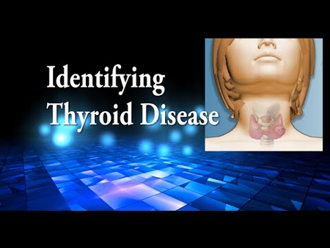 Identifying Thyroid Disease: Monique Manganelli, MD, Endocrinologist