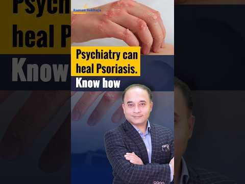 What has Psoriasis got to do with Psychiatry? | Psychiatrist in Cardiff | Dr. Raman Sakhuja