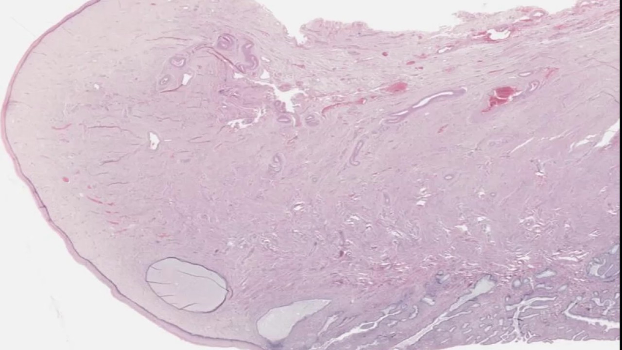 Histology of the Cervix