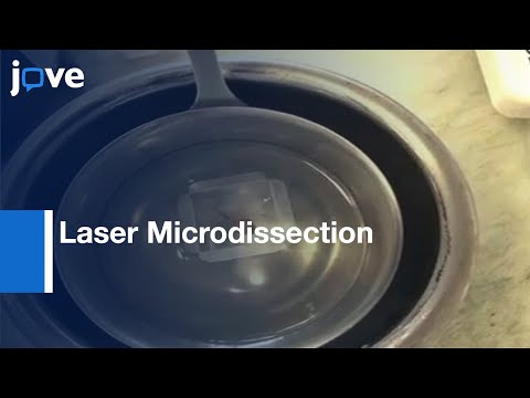 Laser Microdissection of Human Pancreatic Islets | Protocol Preview