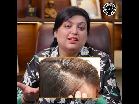Females: Hair Loss? Causes, Symptoms, & Treatment