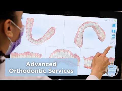 Graceful Smiles: Advanced Orthodontics for a Perfect Smile
