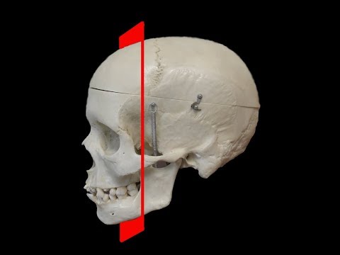 How to Read CT Sinus Scans - A Layperson's Guide