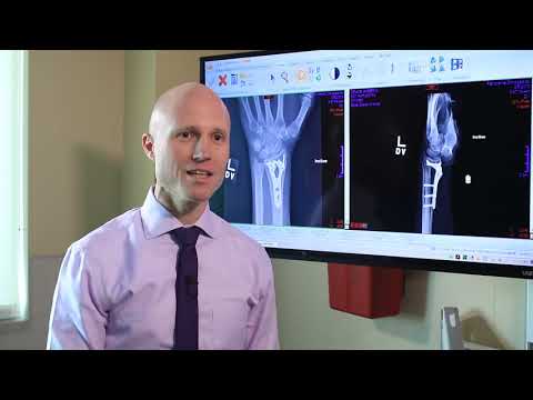 Broken Wrists: Fracture Types, Treatment Options, & Recovery - Dr. Froelich