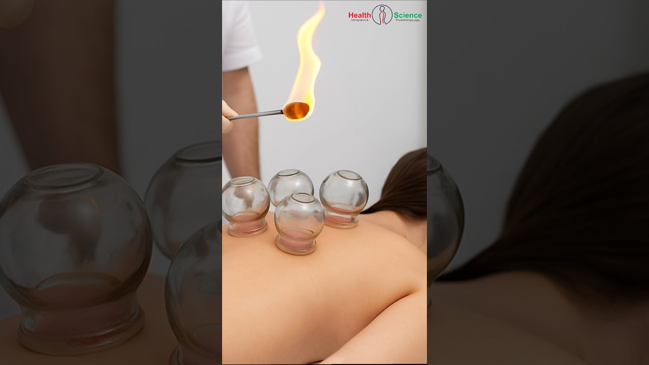 natural Fire Cupping Therapy for Back Pain | Instant Relief for Upper & Lower Back |