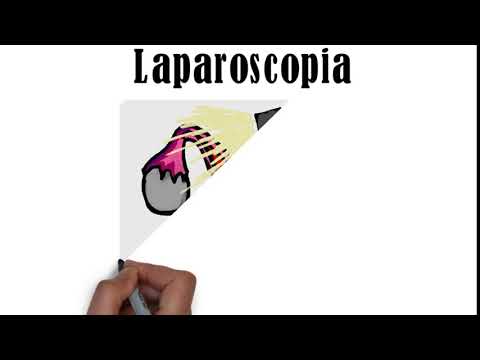 Spanish Medical Interpreter-Spanish Medical Terminology-How to Pronounce Laparoscopy in Spanish