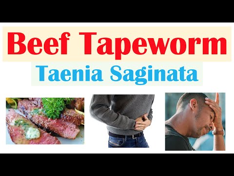 Beef Tapeworm (Taeniasis) | How It Infects, Signs & Symptoms, Diagnosis, Treatment, Prevention