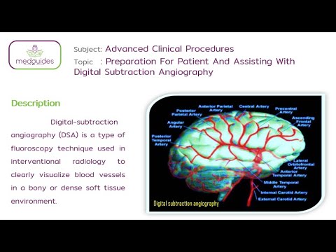 35.Digital Subtraction Angiography