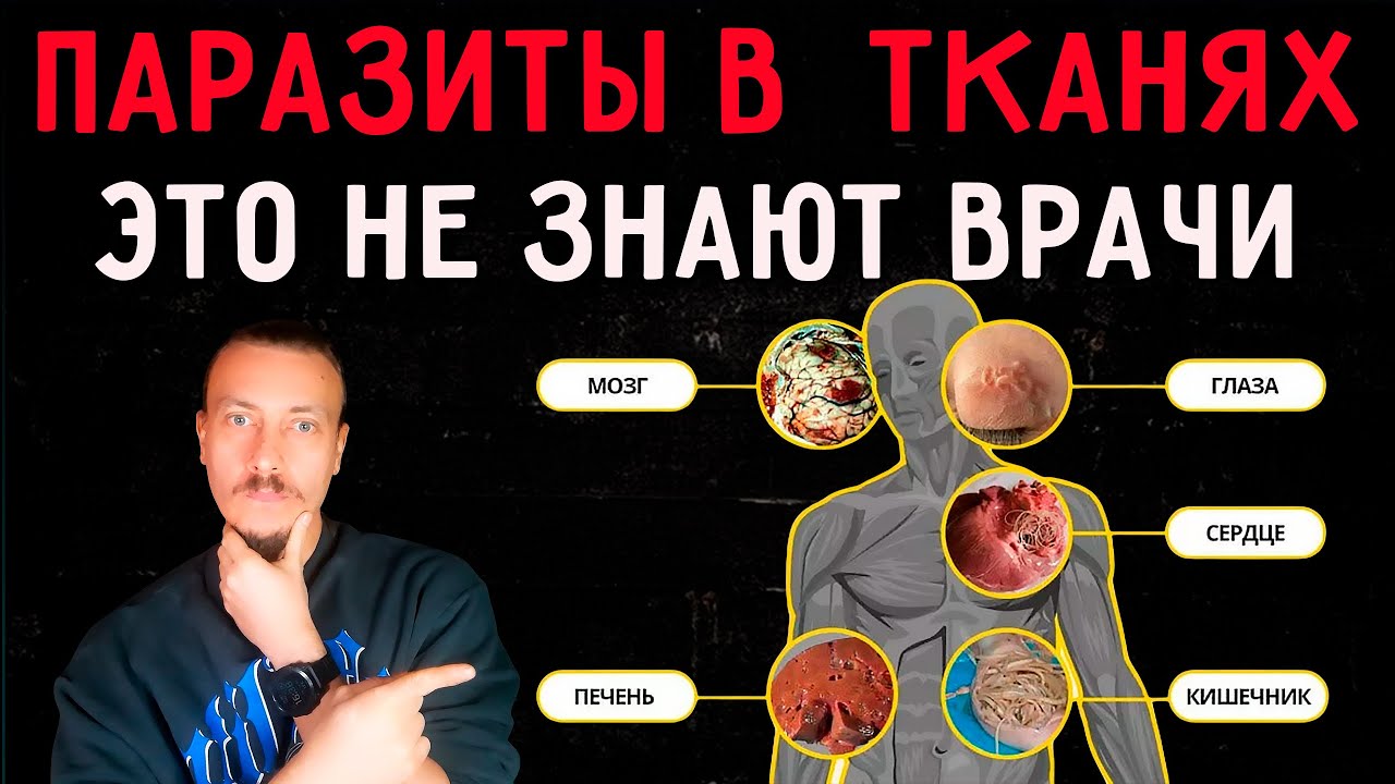 Understanding Tissue Parasites: A Hidden Cause of Chronic Illness ...