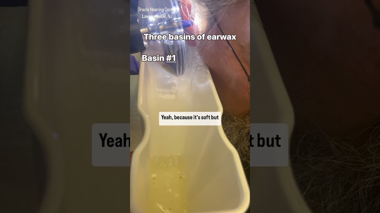 THREE basins of earwax 😱