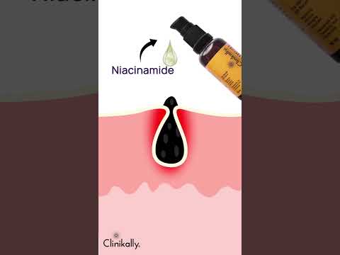 How Niacinamide Works on Acne & Dark Spots | Doctor's Tips