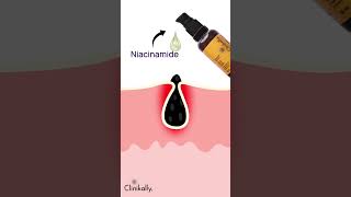 How Niacinamide Works on Acne & Dark Spots | Doctor's Skincare Tips
