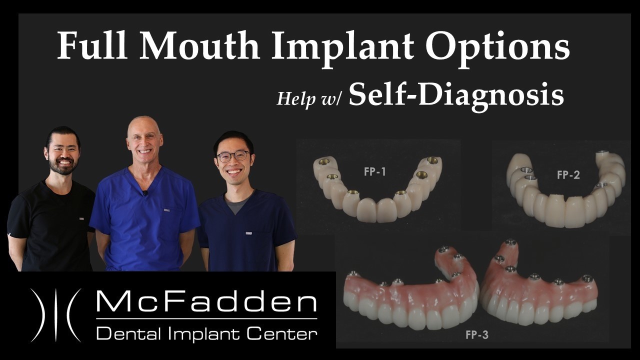 Self Diagnosis for Full Mouth Implant Options/Which You Qualify For