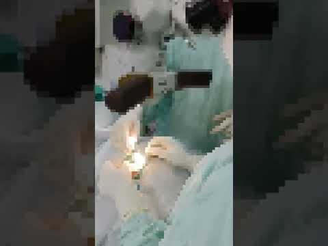OPHTHALMOLOGY OT SCENES | DR. PRASANJIT DAS | #shorts