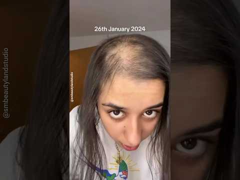 🔥30 Days Hair Growth Challenge 😱 | Hair Growth Tips ✅ #shorts #youtubeshorts Smbeautylandstudio