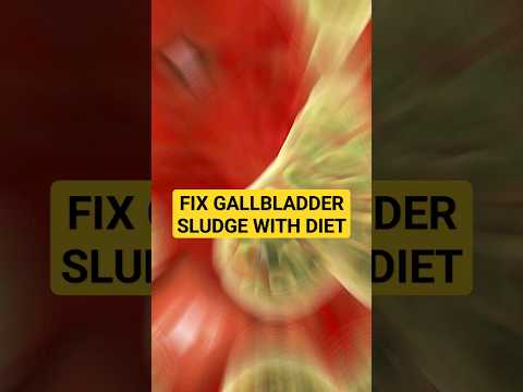 The Best Diet To Help Gallbladder Sludge