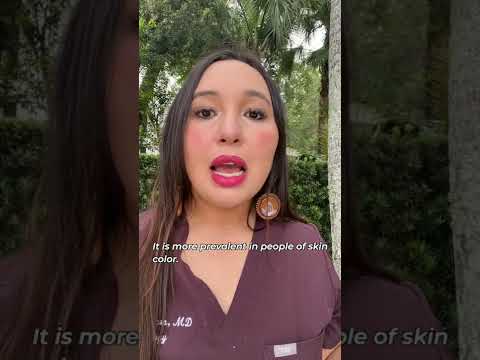 Can melanonychia turn into melanoma? - Dr. Anna Chacon