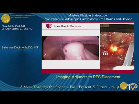 Imaging Adjuncts to PEG Placement