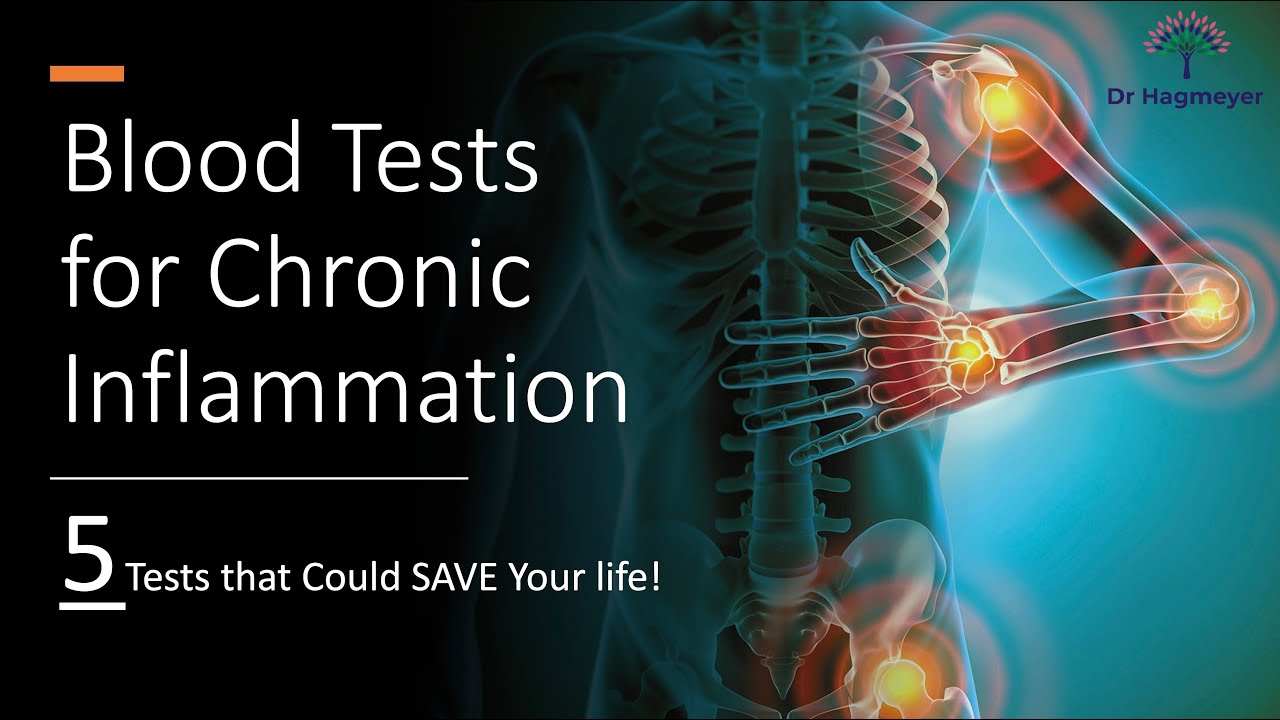 5 🩸Tests Best for  Chronic Inflammation- ⚠️5 Tests That Could Save Your Life