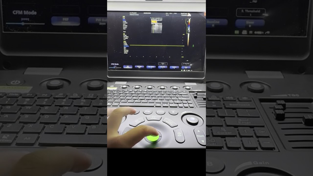 How to use Dolphi-C Ultrasound  -Part 3 BLood vessel