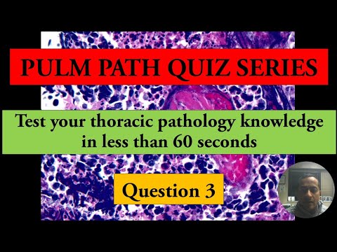 Test your thoracic pathology knowledge in less than 60 seconds. Question 3