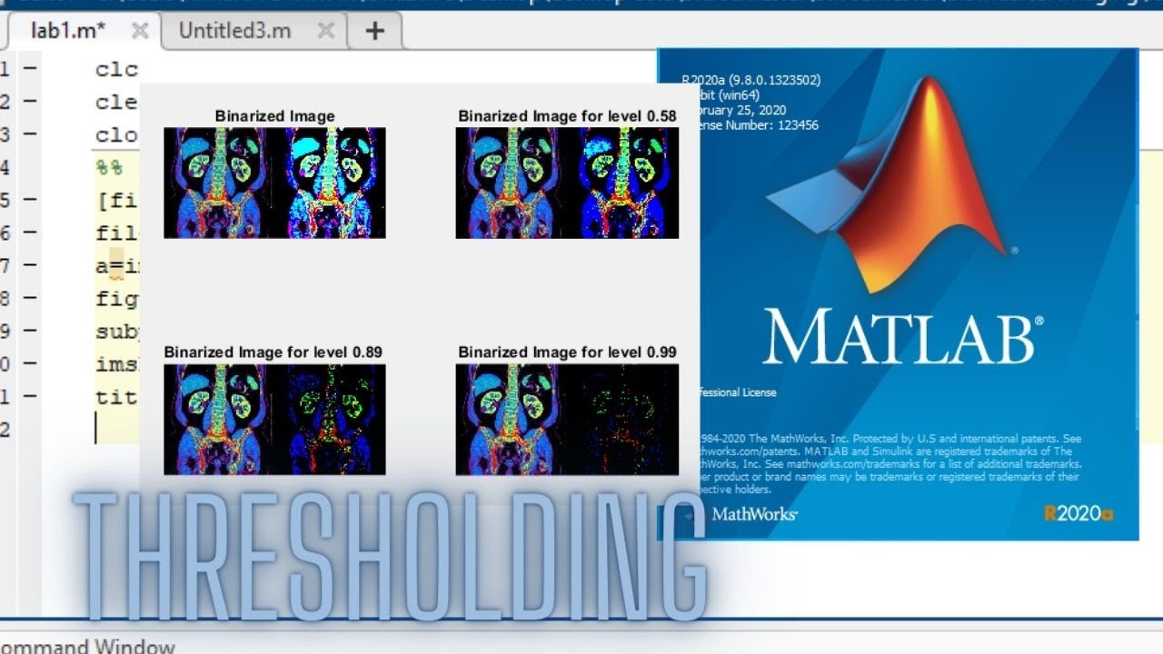Image Processing In MATLAB | Thresholding  | Binarization