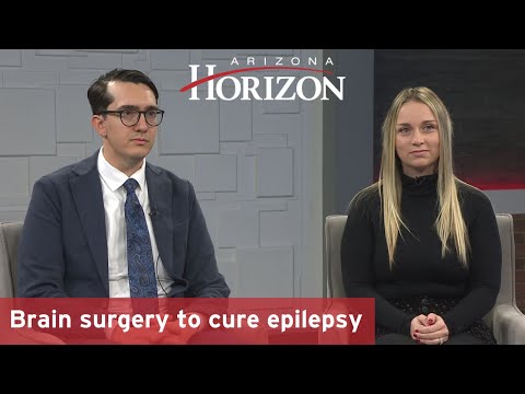 Sometimes it is brain surgery: Patient and doctor share story of epilepsy treatment