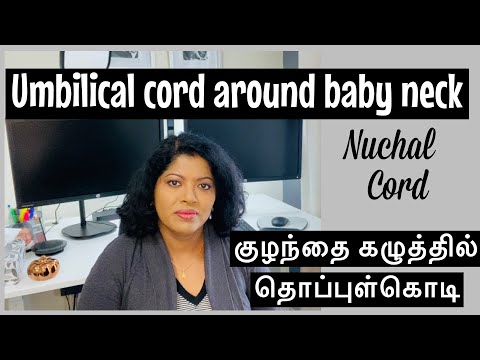 Umbilical cord around baby’s neck in pregnancy in Tamil| Nuchal cord in Tamil| கொடி சுற்றி இருந்தால்