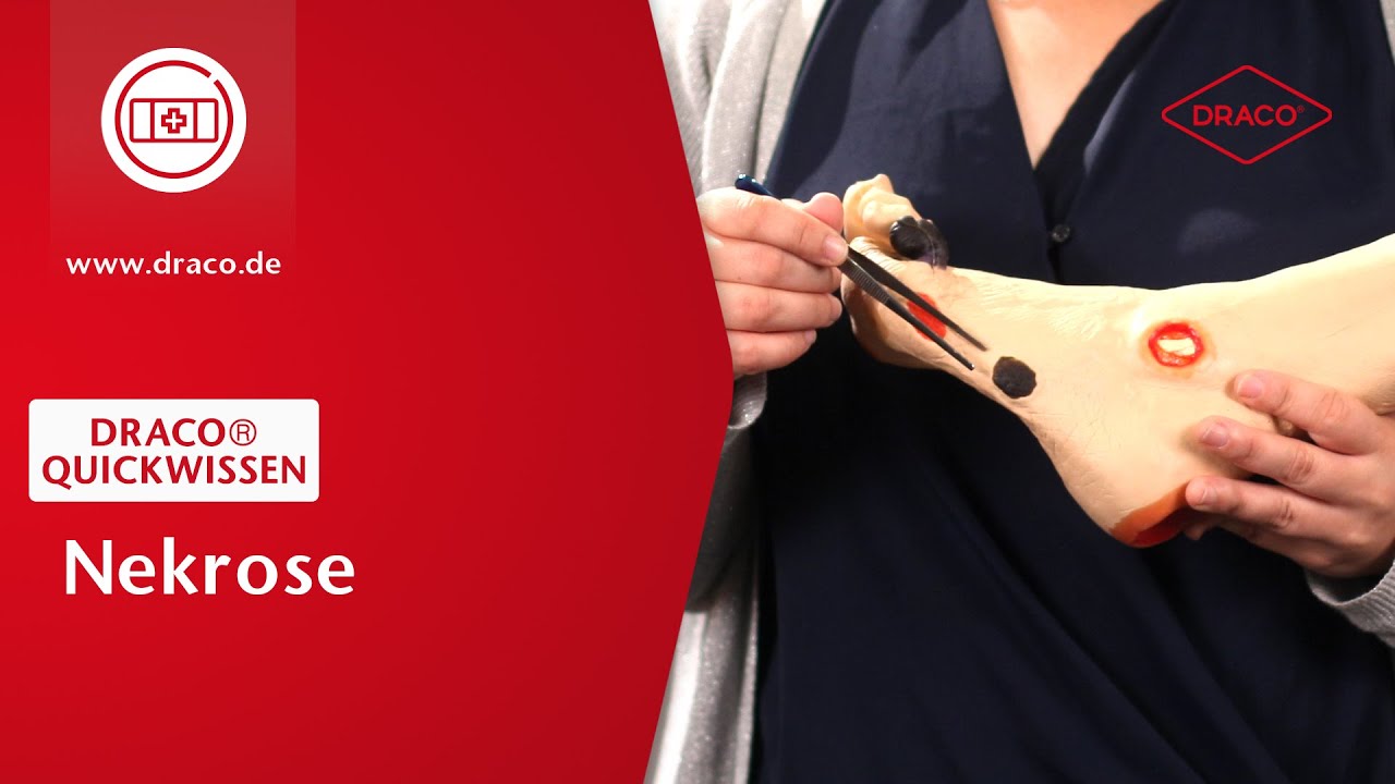 Understanding Necrosis: Types, Treatment, and Implications | Galaxy.ai