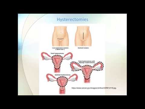 2017: Update on Current Pap Smear Screening Guidelines and Management of Abnormal Pap Results