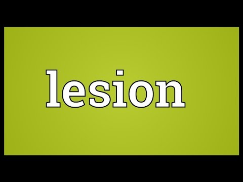 Lesion Meaning