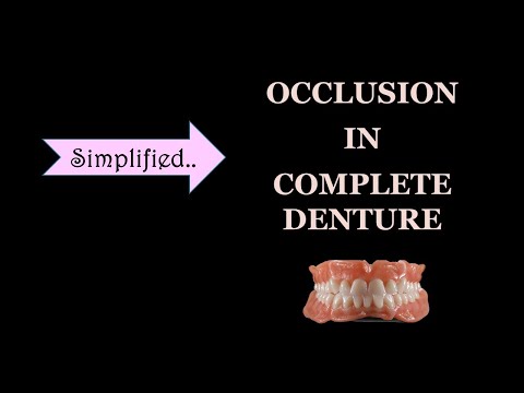 OCLUSION IN COMPLETE DENTURE / BALANCED OCCLUSION
