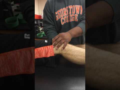 Patellar Subluxation